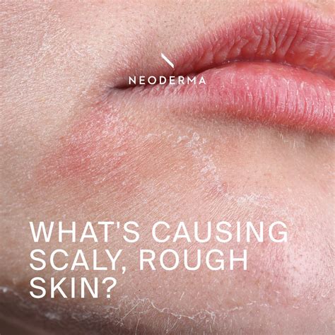 Clean Beauty Products Pure Effective Skincare Solutions Neoderma