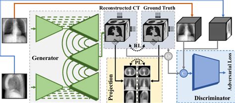overview of the x2ct gan model rl and pl are abbreviations of the