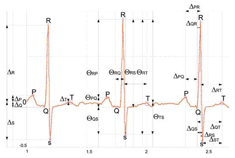 Ecg Identification Based On The Gramian Angular Field And Tested With
