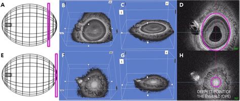 Schematic Presentation Of The Three Dimensional 3d Tomogram Of The