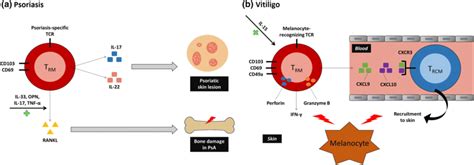 Role Of Trm Cells In A Psoriasis And B Vitiligo A Resolved Psoriatic