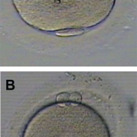 Mii Oocytes After Denudation Of Cumulus Cell Before Microinjection A Download Scientific