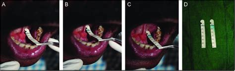 Placement And Wettability Of The Strip In MST A After 1 Min B Download Scientific Diagram