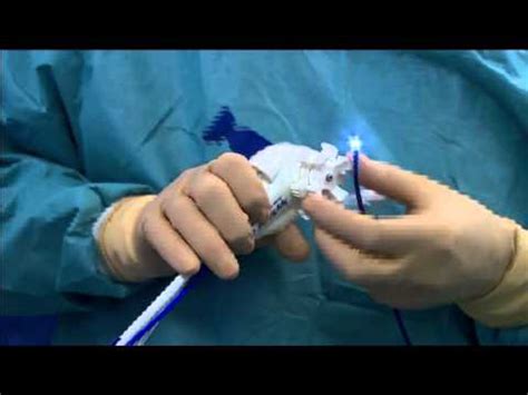 Cholangioscopie Par SpyGlass YouTube