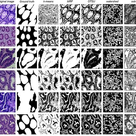 Five Types Of Data Segmentation Results Obtained By Different Classical Download Scientific