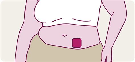 Safety Information For Estradiol Patch