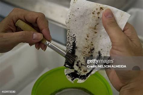 Microinjection Photos And Premium High Res Pictures Getty Images