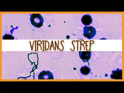 Viridans Streptococci S Mutans S Mitis S Sanguinis 2025