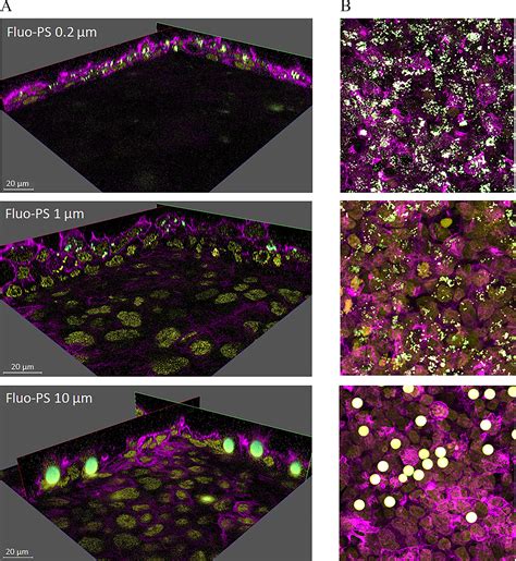 Uptake Transport And Toxicity Of Pristine And Weathered Micro And Nanoplastics In Human
