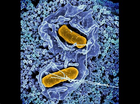 Doxycycline Inducible Gene Switch System For Bacteria Mediated Cancer