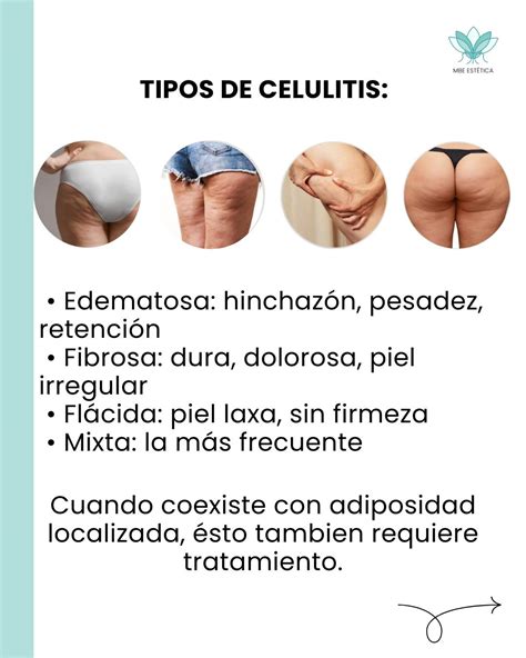 Mbe Estética