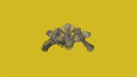 Fractured Pelvis Segmentation 3d Model By Mizere 2b940f0 Sketchfab