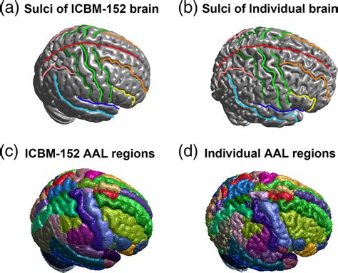 Parcellation Of Individual Brains According To The Automated Anatomical Download Scientific
