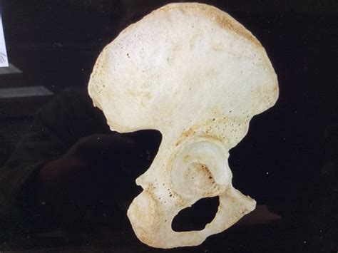 Appendicular Skeleton Lower Body Flashcards Quizlet