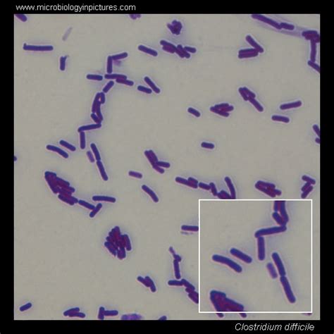Clostridium Difficile Foamid