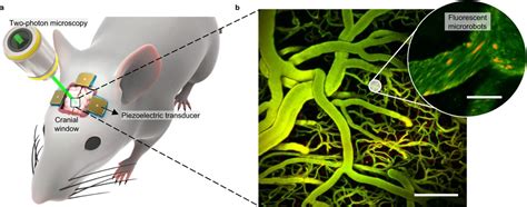 Navigating The Brains Pathways Ultrasound Activated Microrobots Meet Microfluidics