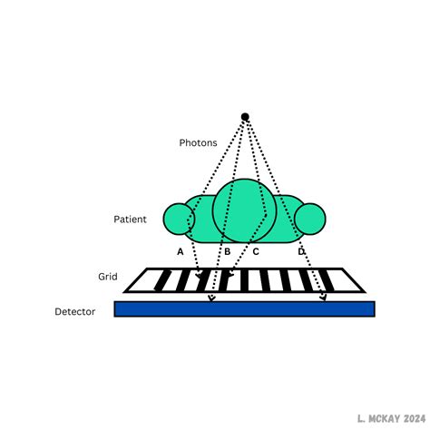 Image Radiopaedia Org