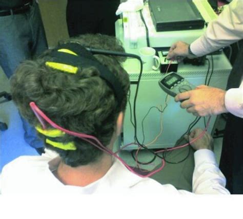 Transcranial Direct Current Stimulation