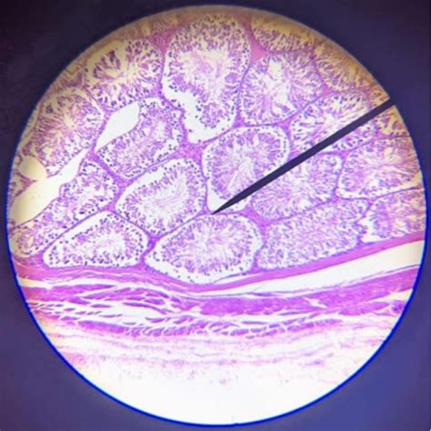 Solved Label And Indicate Septa Onto Testis Photo Indentify Chegg Com