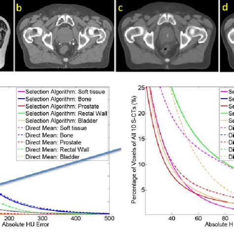 Pdf Mr Image Based Synthetic Ct For Imrt Prostate Treatment Planning And Cbct Image Guided