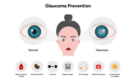 Premium Vector Prevention Glaucoma Medical Information Ophthalmologist