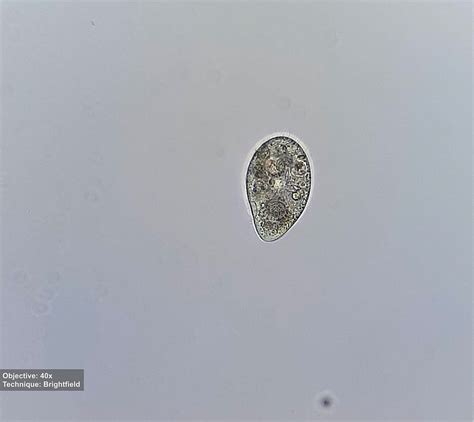Tetrahymena From Детская площадка ул Пулковская Московский р н Санкт Петербург Россия On