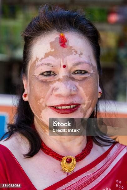 길거리에서 얼굴에 색소 반점 가진 초상화 늙은 여자 포카라 네팔 거리에 대한 스톡 사진 및 기타 이미지 거리 건강관리와 의술 네팔 Istock