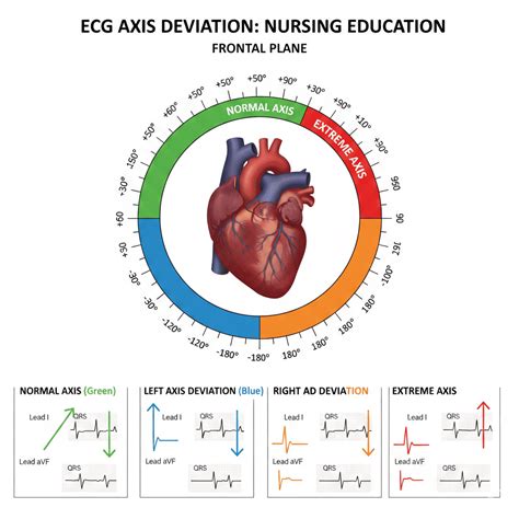 Axis Deviation Explained How Nurses Determine Ecg Axis