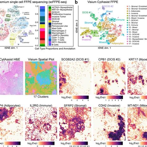 Integrating Scffpe Seq And Xenium Data Deciphers Differences In Cell