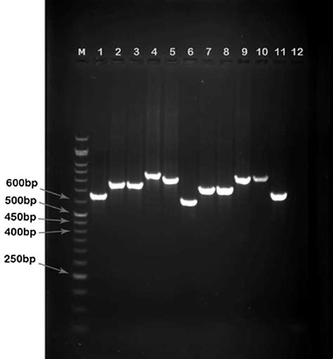 Pcr Amplification Of Mdr Isolates Using Miru 10 Primers Lanes M Dna Download Scientific