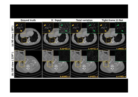 Deep Learning For Ct Reconstruction From Concept To Practices Speaker Deck