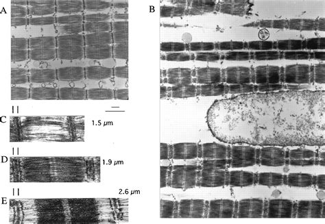 Sarcomere In Cardiac Microscope Labeled