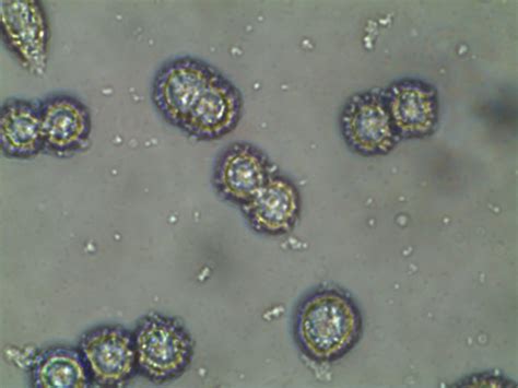 279 Questions With Answers In Turbidity Science Topic