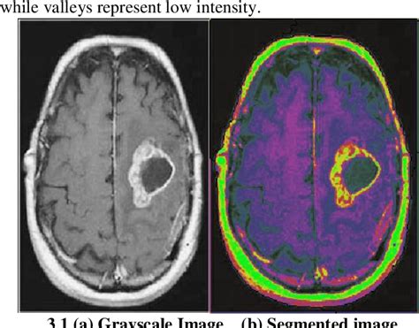 Figure 1 From Convolutional Neural Network Based Medical Image Classifier Semantic Scholar