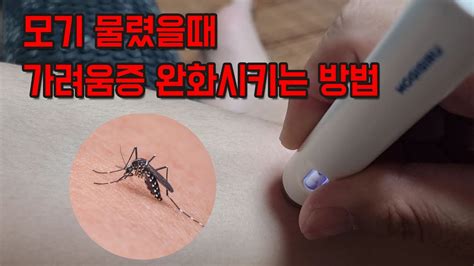 모기물렸을때 이것 하면 안가려워요 Youtube