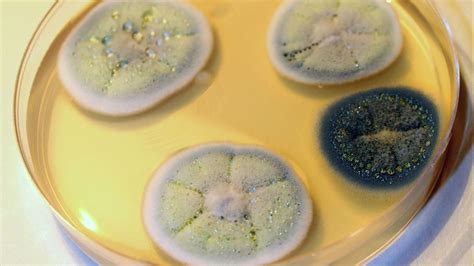 28 Facts About Penicillin Ohmyfacts