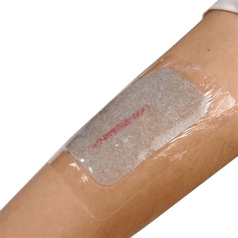 Burn Wound Care Second Degree Burn Wound Dressing 1010cm Bordered
