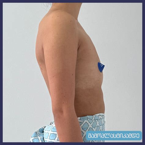 კან კანვენი კანისა და ვენსნეულებათა ს კ ეროვნული ცენტრი