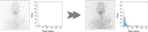 Figure 2 From A Deep Learning Method Using Spect Images To Diagnose