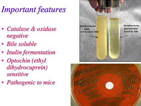 Ppt Streptococcus Pneumoniae And Viridans Group Of Streptococci Powerpoint Presentation Id 2884122
