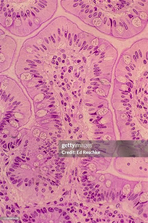 Simple Columnar Epithelium Small Intestine