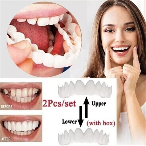 Smile Snap On False Teeth Set Upper Lower Denture Veneers Dental