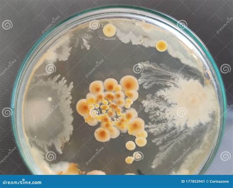 Bacillus Subtilis Other Bacteria And Fungi Colonies On Saboraud Dextrose Agar Medium Stock Image