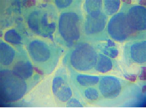 Microscopic Image In Diff Quick Stain Objective 100x10 Figure 4 Download Scientific Diagram