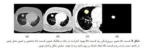 Part A Ct Scan Image Of The Lung Part B Improvement Of Contrast In Download Scientific