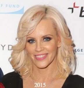 Jenny Mccarthy Plastic Surgery Before And After Photos Latest Plastic