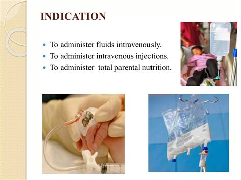 Pediatric Intravenous Cannulation Pptx Pediatric Intravenous Cannulation Pptx