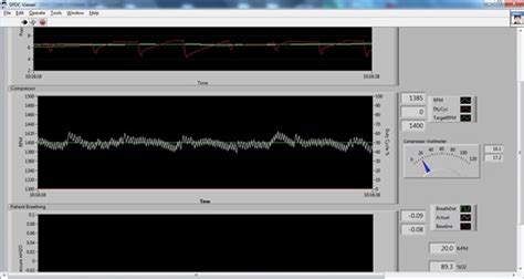 Instaspin Bldc Motor Control In 28035 Device C2000 Microcontrollers