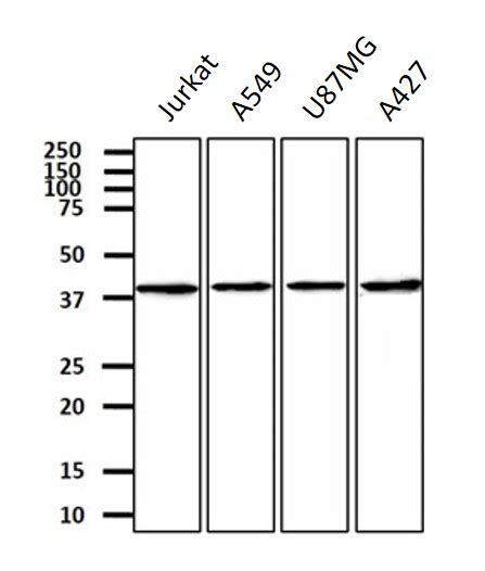 Anti Ctgf Antibody [18e7] Arg57496 Arigo Biolaboratories