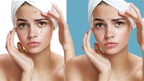 Heal Layers Tool Remove Unwanted Objects Fix Skin Capture One Pro Tutorial YouTube